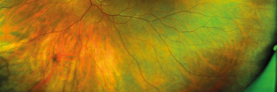 Heidelberg Spectralis OCT - Burnett Hodd & Tam Optometry