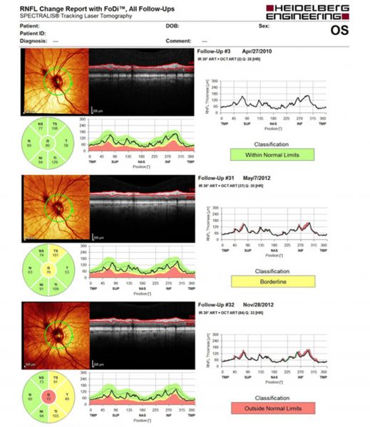 Heidelberg Spectralis OCT - Burnett Hodd & Tam Optometry