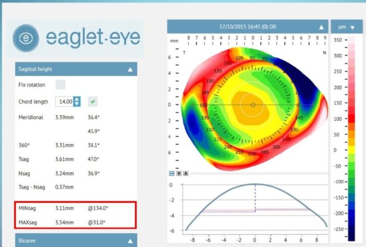 Eaglet Eye ESP - Burnett Hodd & Tam Optometry